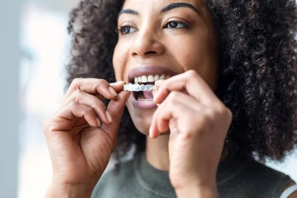 How Does Invisalign Work: 7 Things To Know - Graham Park Dental