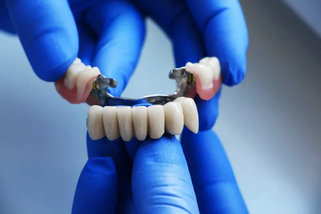 How Do Dental Bridges Work: What You Need to Know - Graham Park Dental